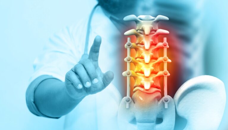 Types of Minimally Invasive Spine Surgery, Mission Viejo, CA