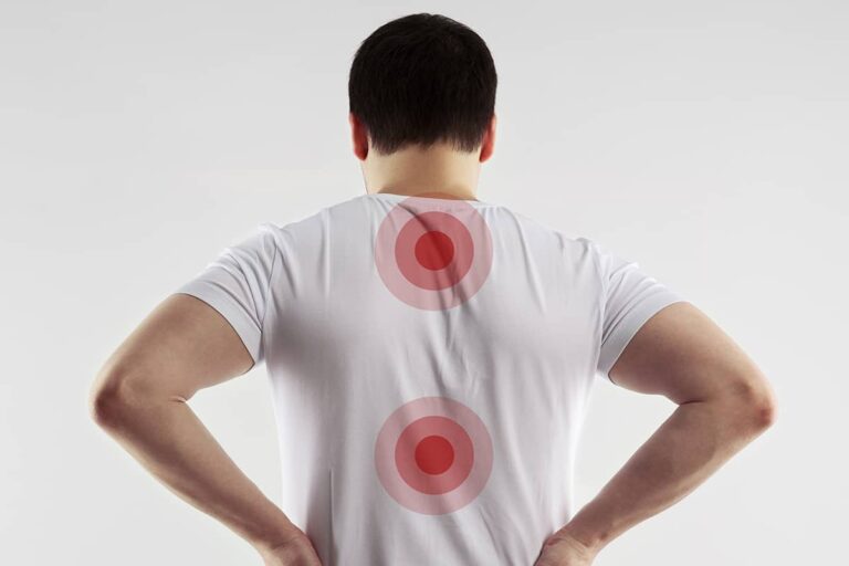 Nevro HF10 Spinal Cord Stimulation | No more chronic back pain