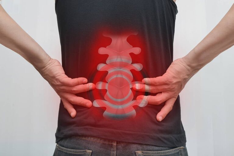 Nevro HF10 Spinal Cord Stimulation | No more chronic back pain